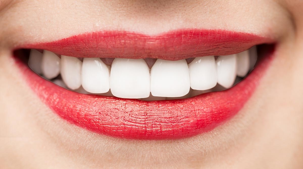 What is in a Smile? – Dental Associates of Walpole